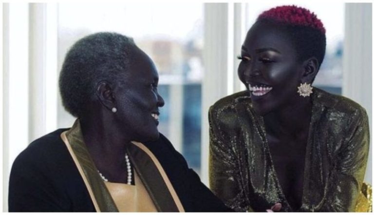 Queen of the Night: An African woman with a rare skin color has become ...